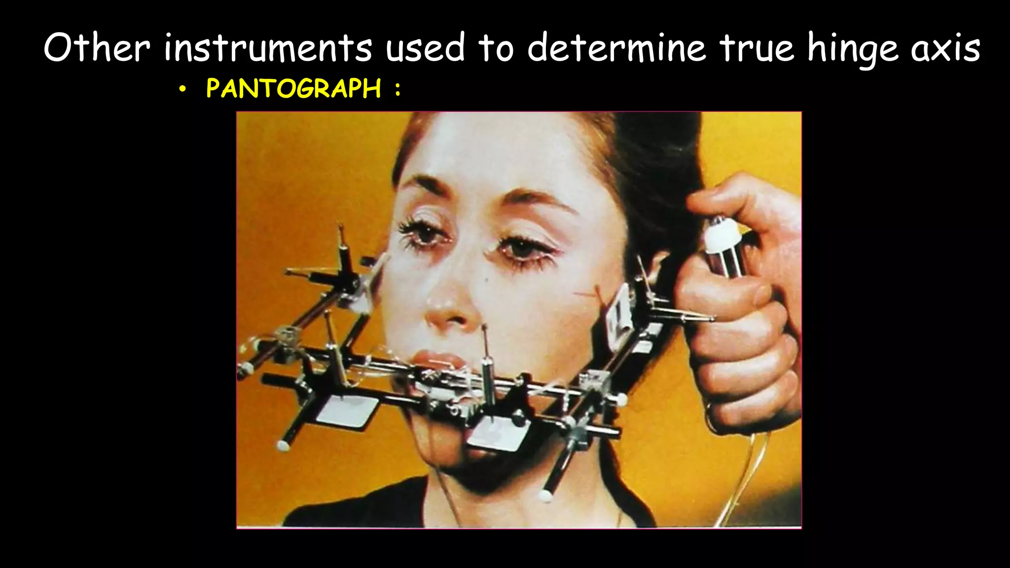 HINGE AXIS.pptx
