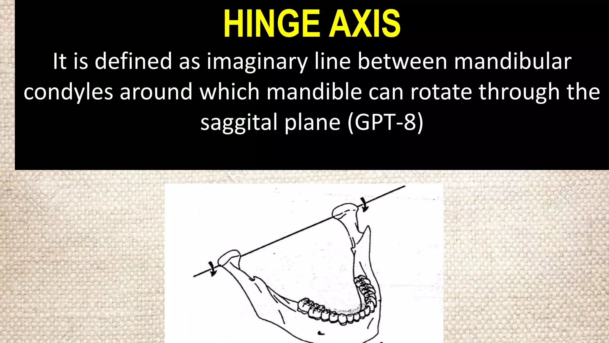 HINGE AXIS.pptx