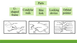 hinge axis and facebow in prosthodontics | PPTX