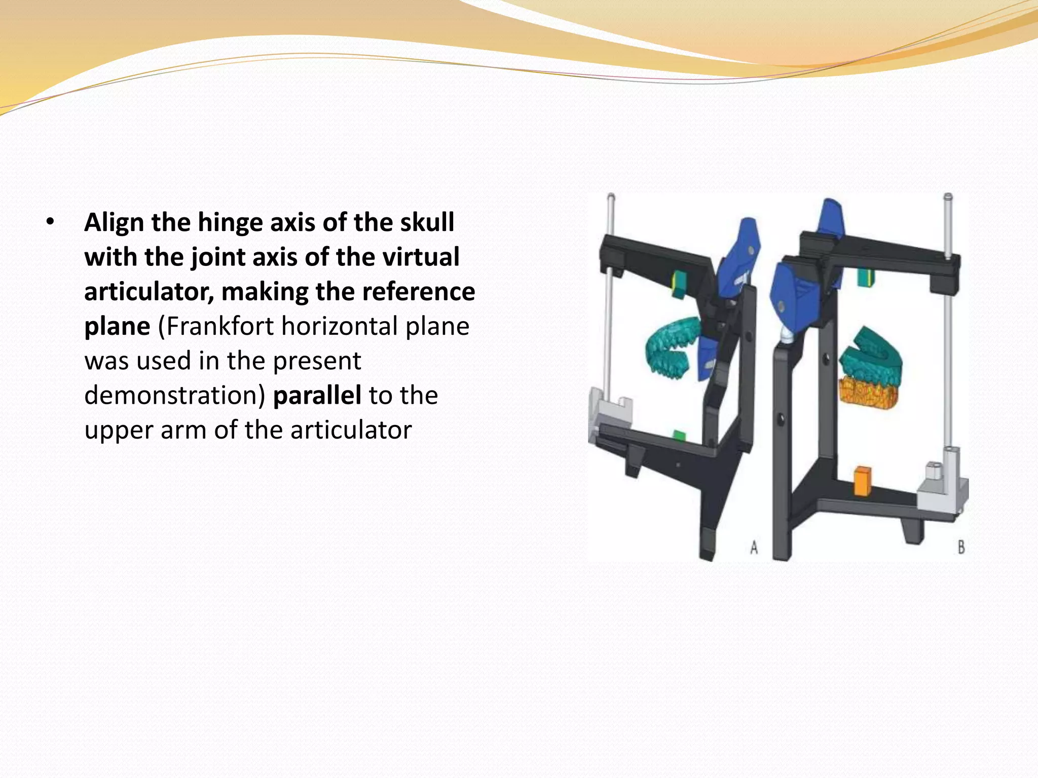 HINGE AXIS AND FACEBOW .pptx