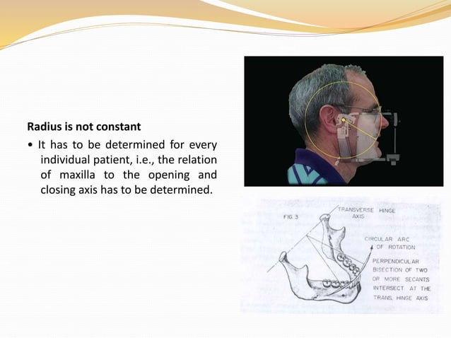 HINGE AXIS AND FACEBOW .pptx | Dental Health | Diseases and Conditions