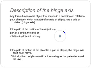 Hinge xis | PPTX