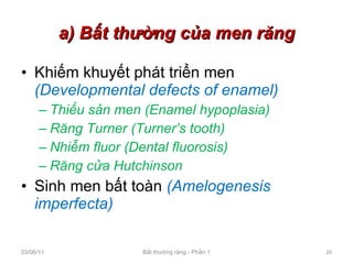 Hinh anh bat thuong rang phan 1 | PPS