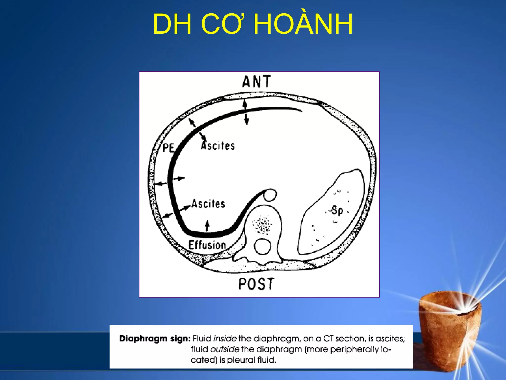 Hinh anh benh ly thanh nguc, mang phoi, co hoanh, bs mai thuy (2018) | PPT