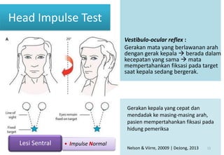 HINTS of Stroke, Bedside Eye Exam Outperforms MRI in Identifying Stroke ...