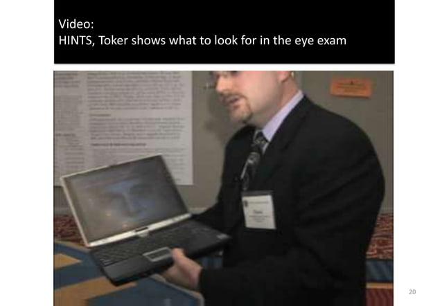 HINTS of Stroke, Bedside Eye Exam Outperforms MRI in Identifying Stroke ...