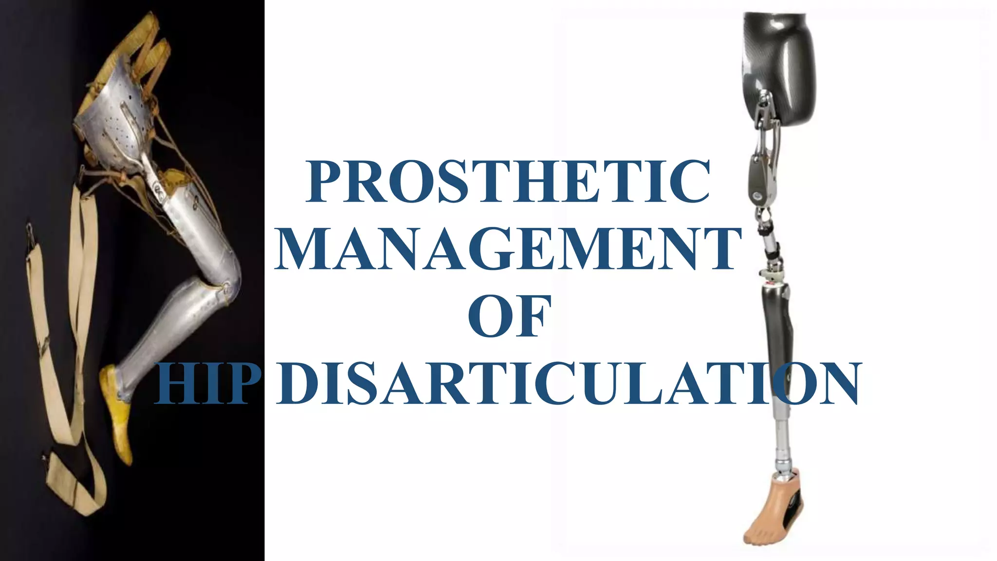 Hip Disarticulation Prosthetic Management | PPTX