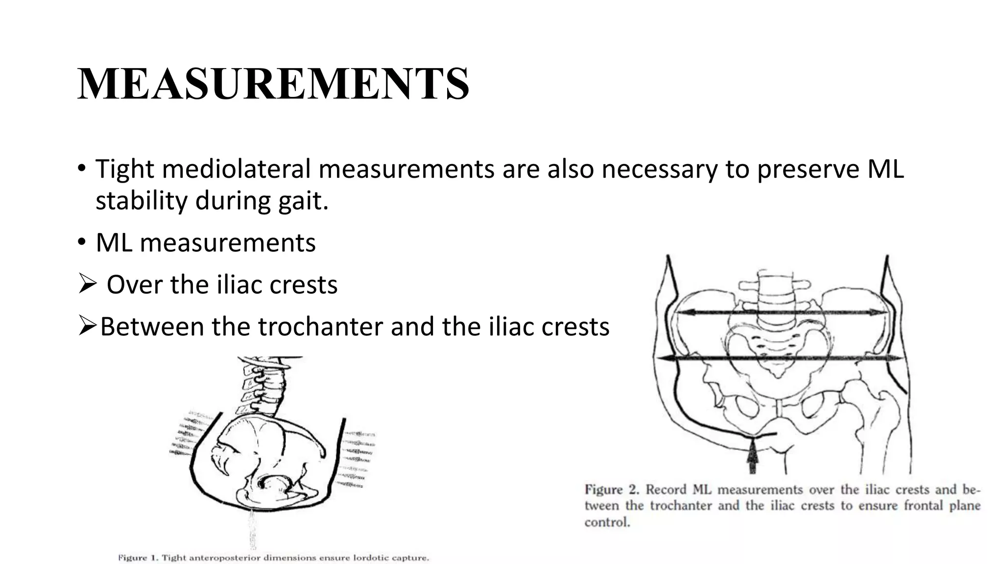 Hip Disarticulation Prosthetic Management | PPTX