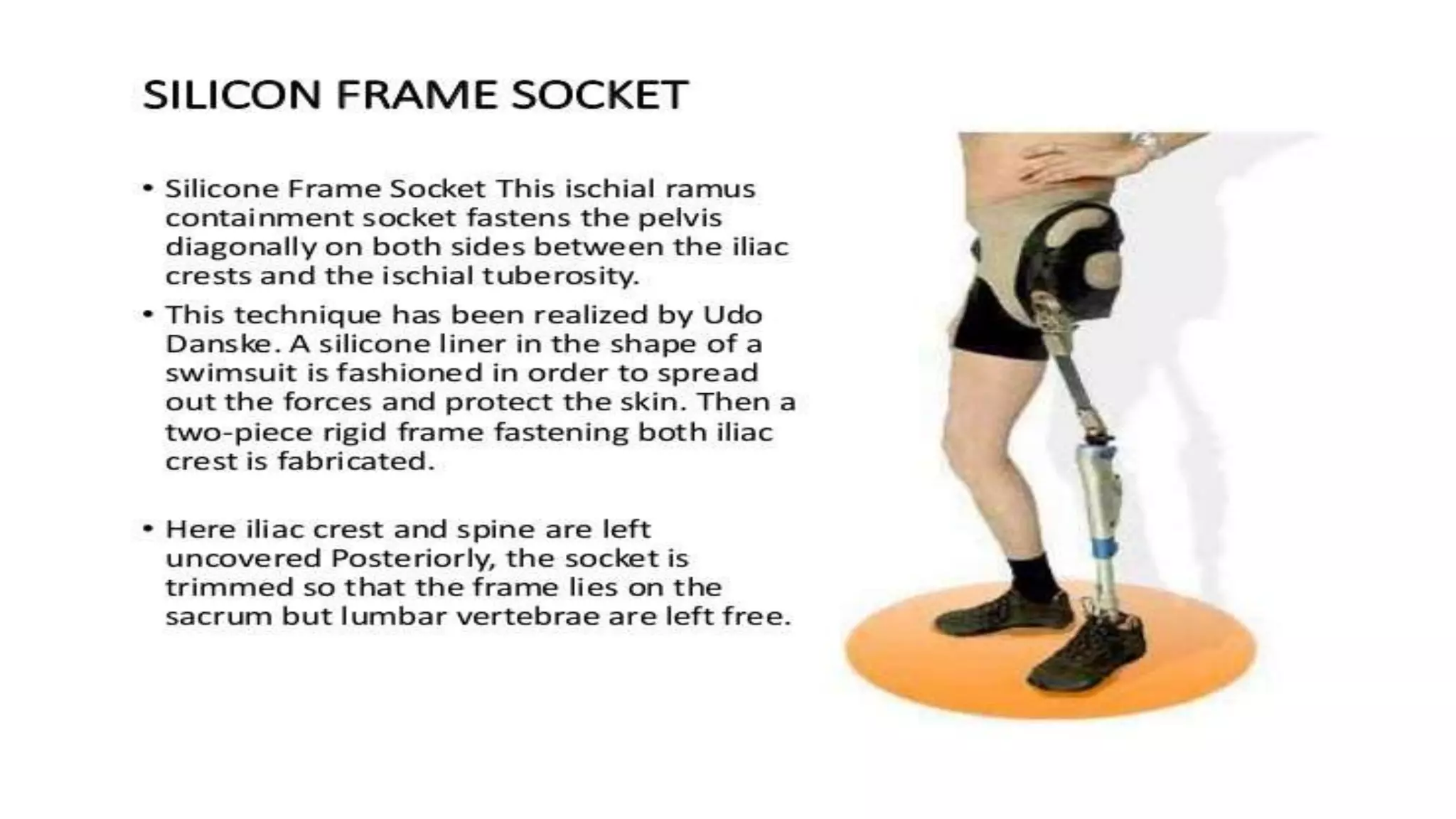 Hip Disarticulation Prosthetic Management | PPTX