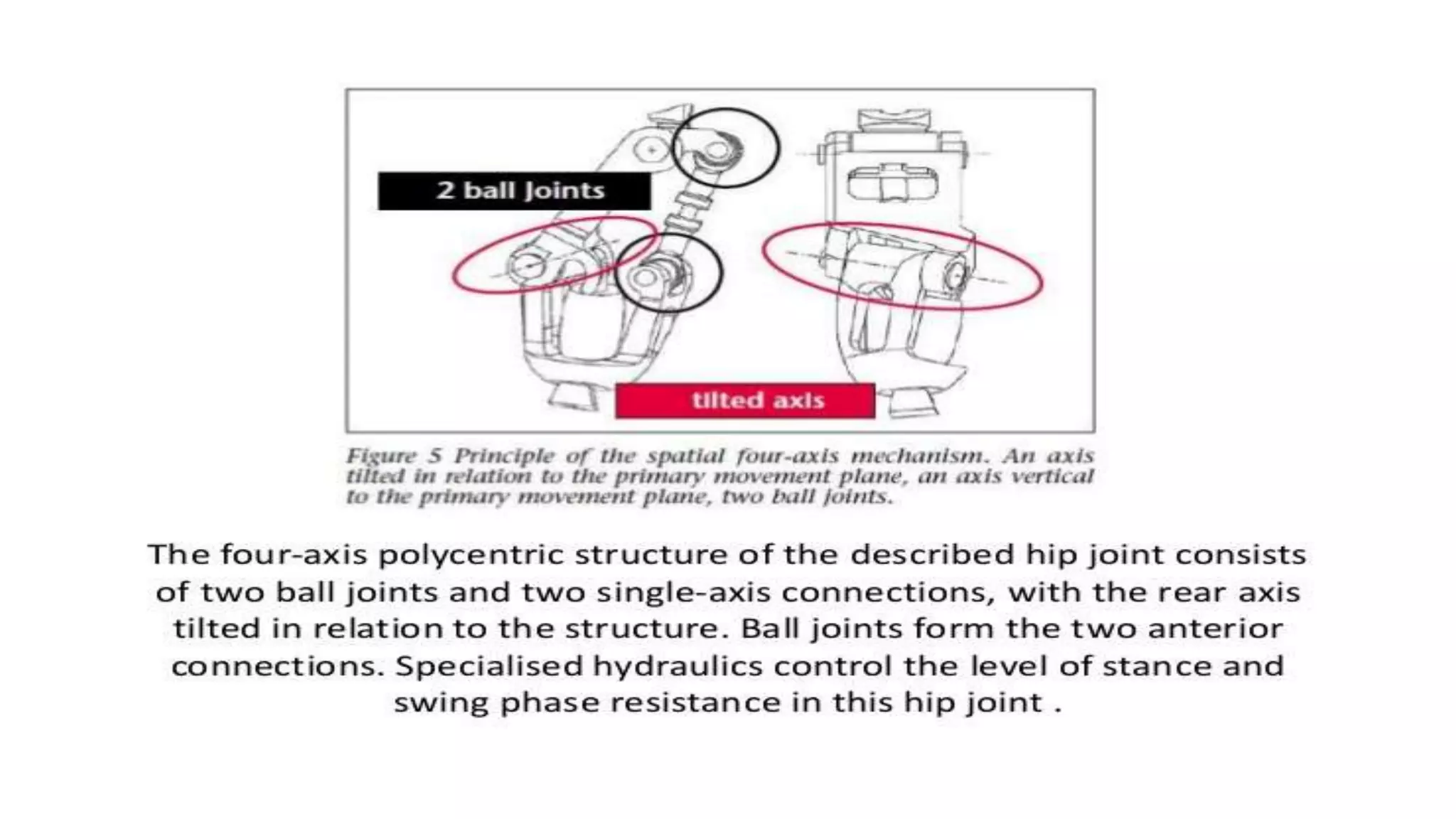 Hip Disarticulation Prosthetic Management | PPTX
