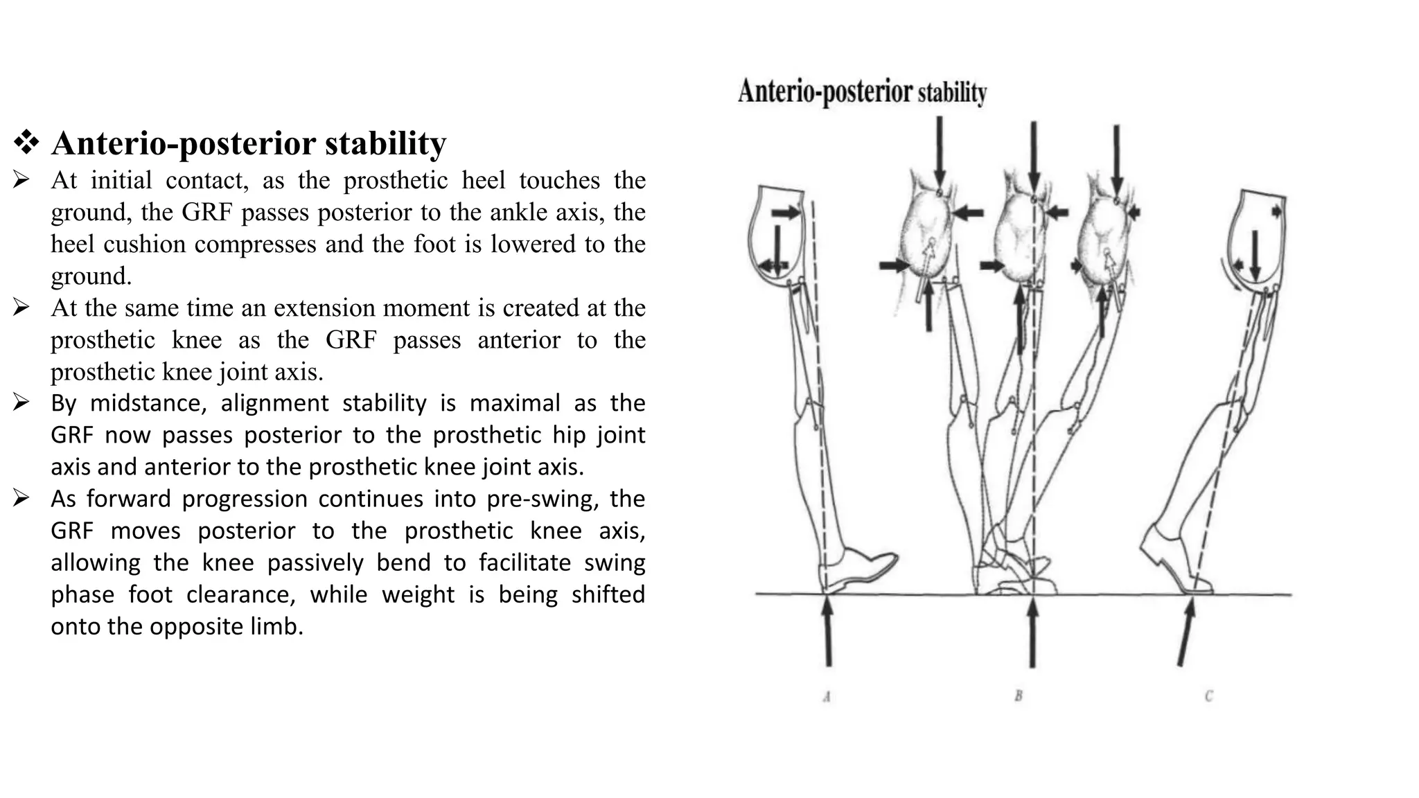 Hip Disarticulation Prosthetic Management | PPTX