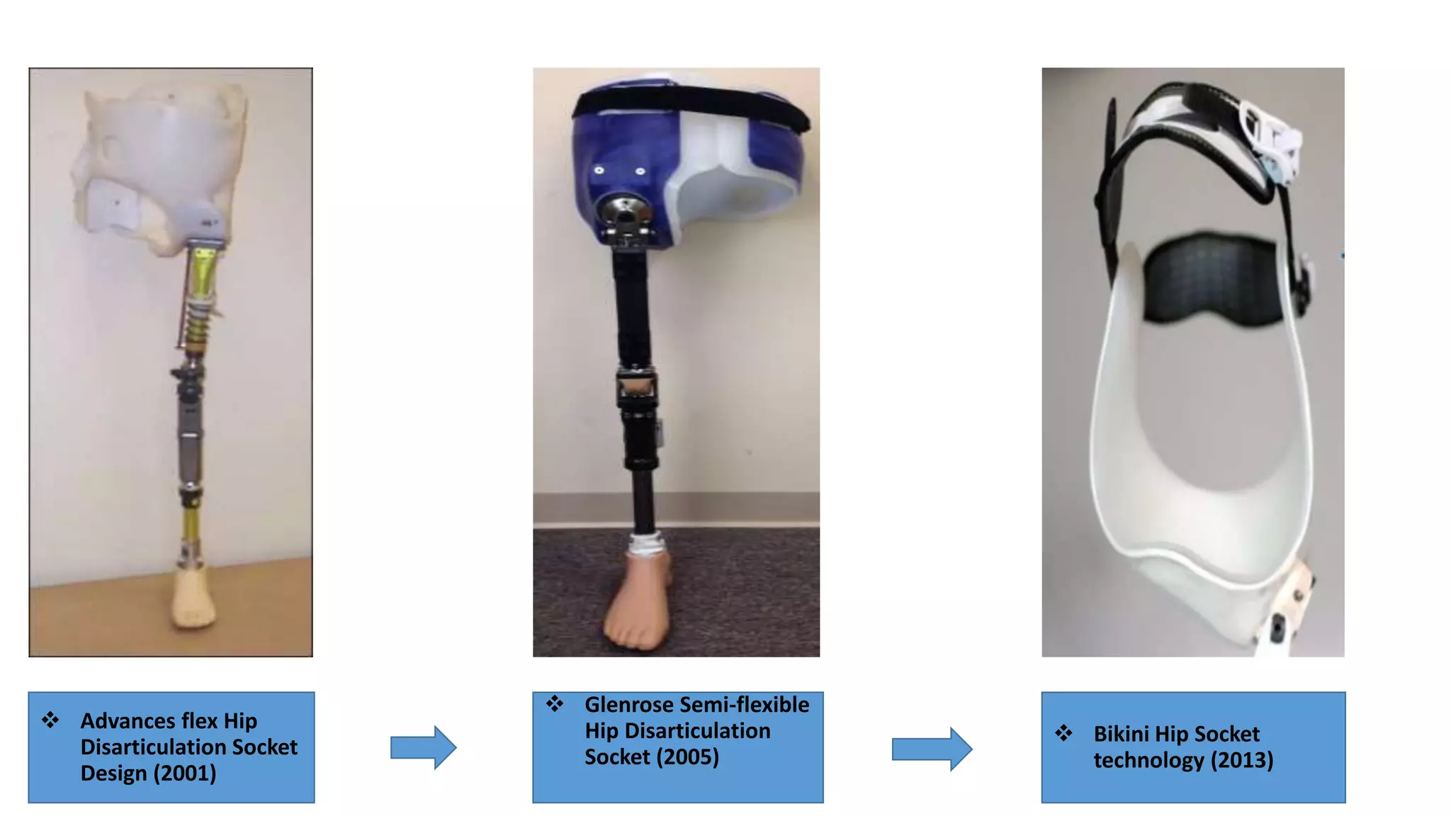Hip Disarticulation Prosthetic Management Ppt