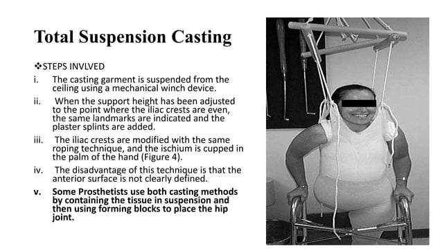 Hip Disarticulation Prosthetic Management | PPTX