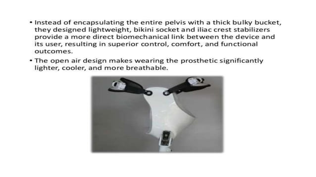 Hip Disarticulation Prosthetic Management | PPTX