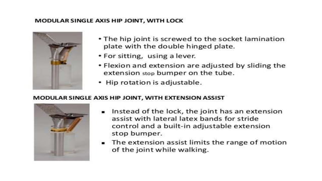 Hip Disarticulation Prosthetic Management | PPTX