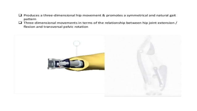 Hip Disarticulation Prosthetic Management | PPTX