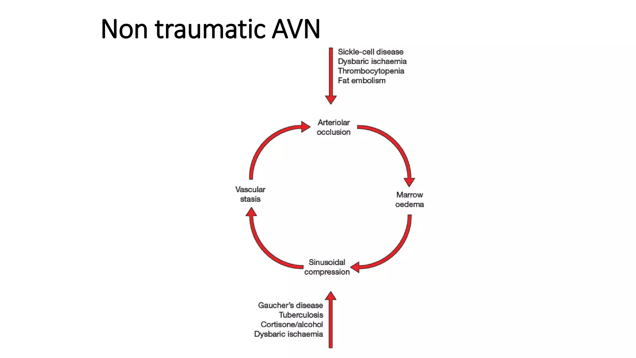 Hip anatomy, approaches & AVN | PPTX
