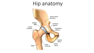 Hip anatomy, approaches & AVN | PPTX