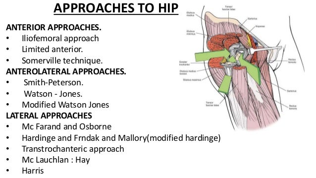 Hip anatomy, approaches & AVN