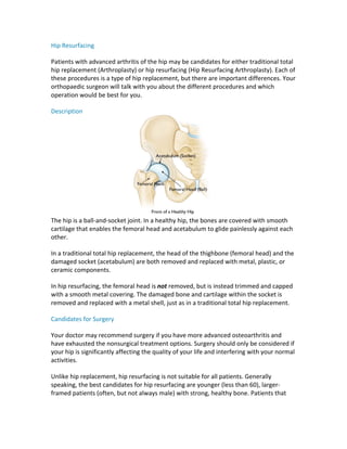 Hip resurfacing | PDF