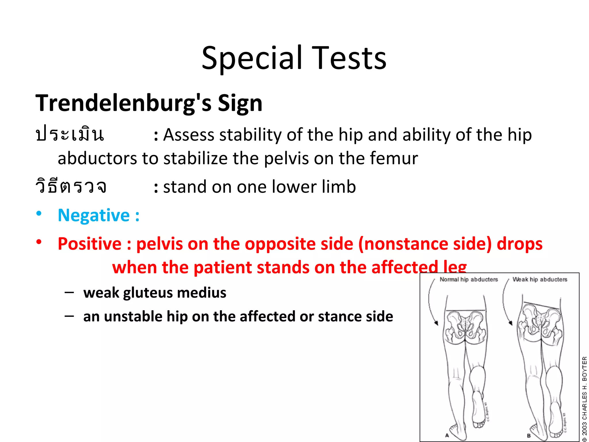 Hip test-complete1 | PPT