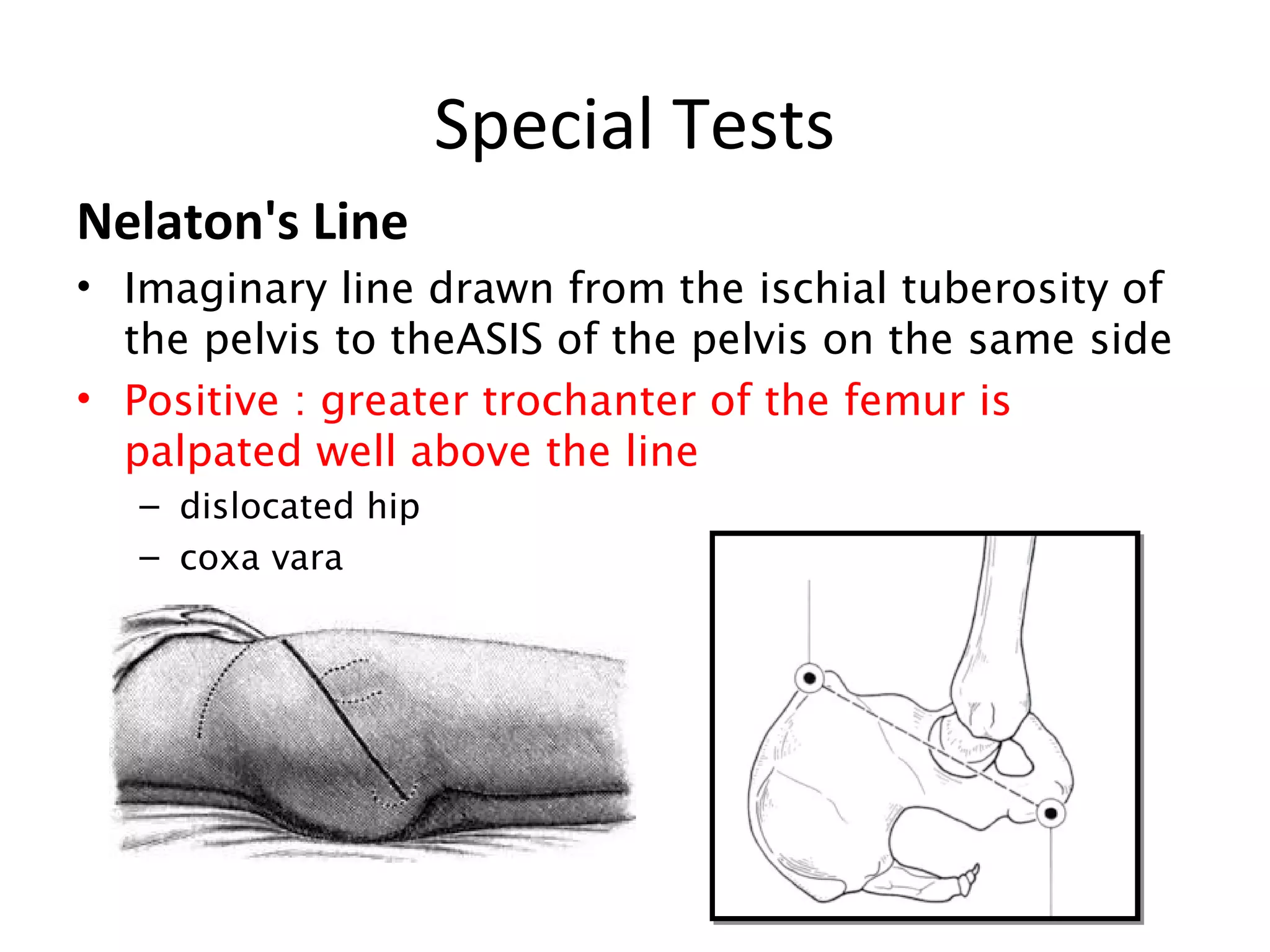 Hip test-complete1 | PPT