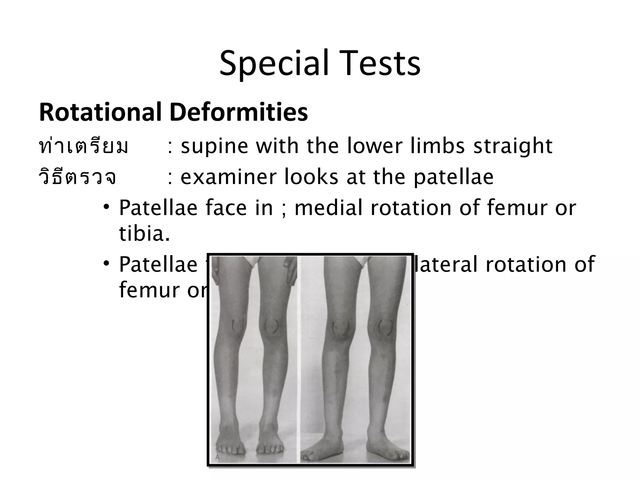 Hip test-complete1 | PPT