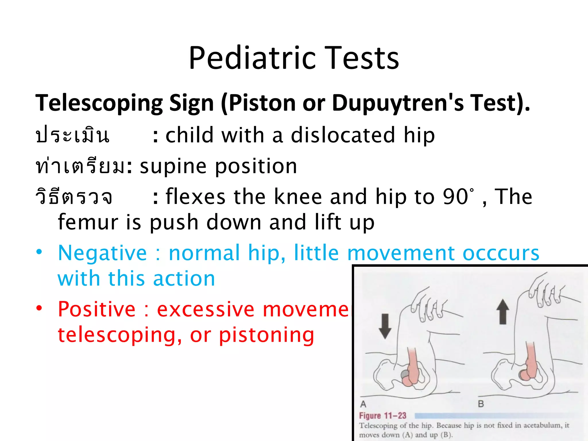 Hip test-complete1 | PPT