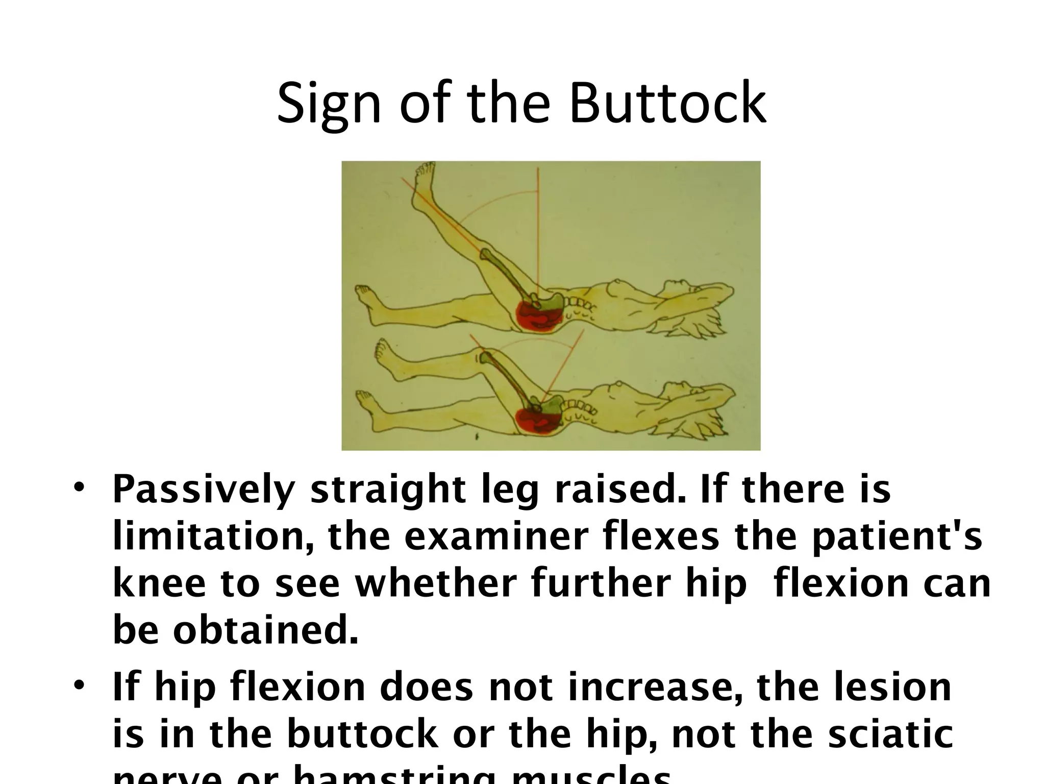 Hip test-complete1 | PPT