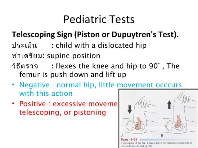 Hip test-complete1 | PPT