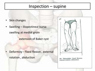 HIP (1) presentation.pptx
