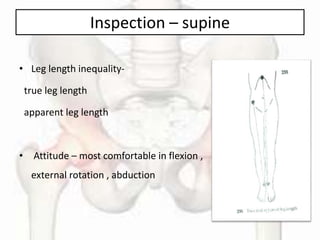 HIP (1) presentation.pptx