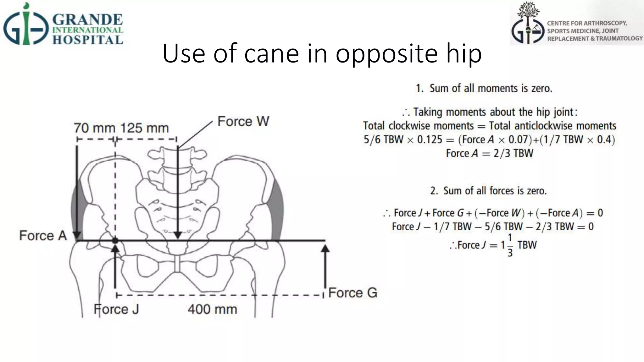 Hip - Anatomy and Biomechanics | PPTX
