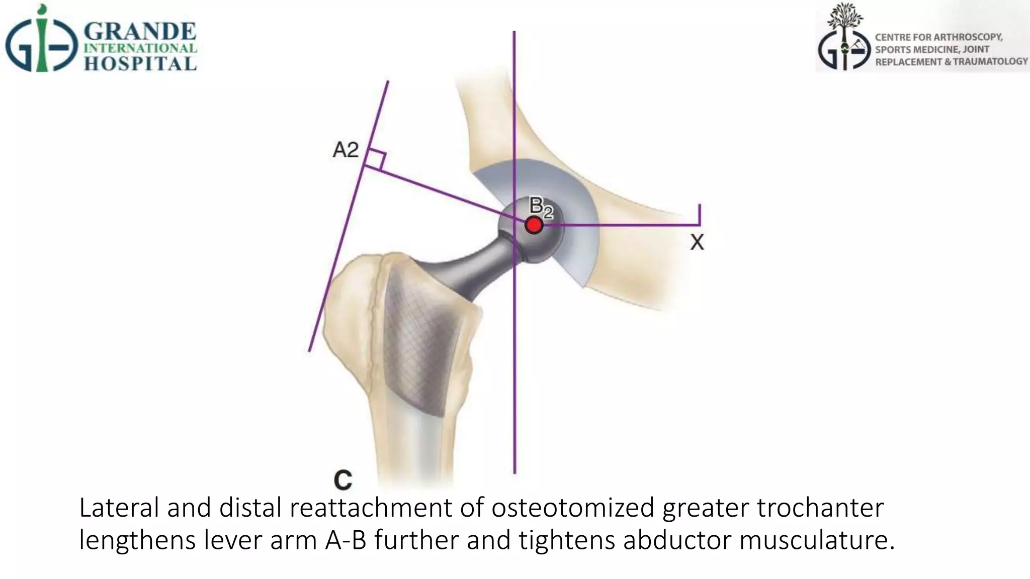 Hip - Anatomy and Biomechanics | PPTX