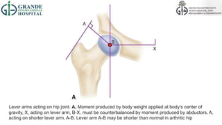 Hip - Anatomy and Biomechanics | PPTX
