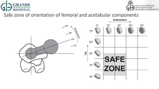 Hip - Anatomy and Biomechanics | PPTX