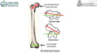 Hip - Anatomy and Biomechanics | PPTX