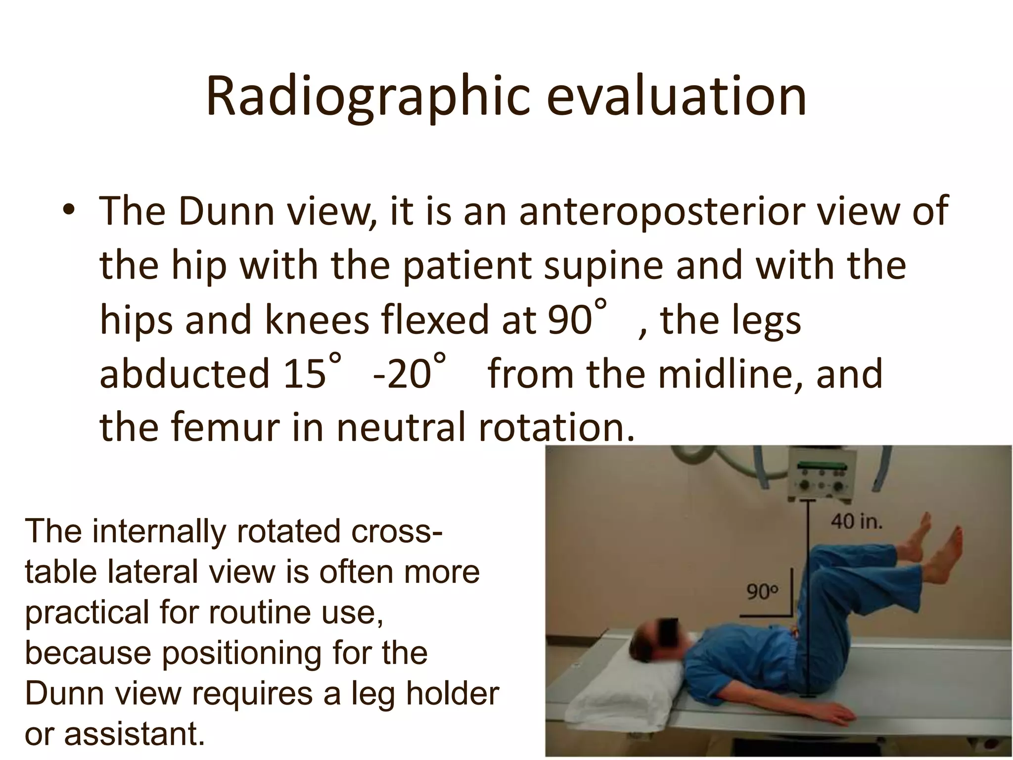 Hip and spine syndrome (PMR) | PPTX