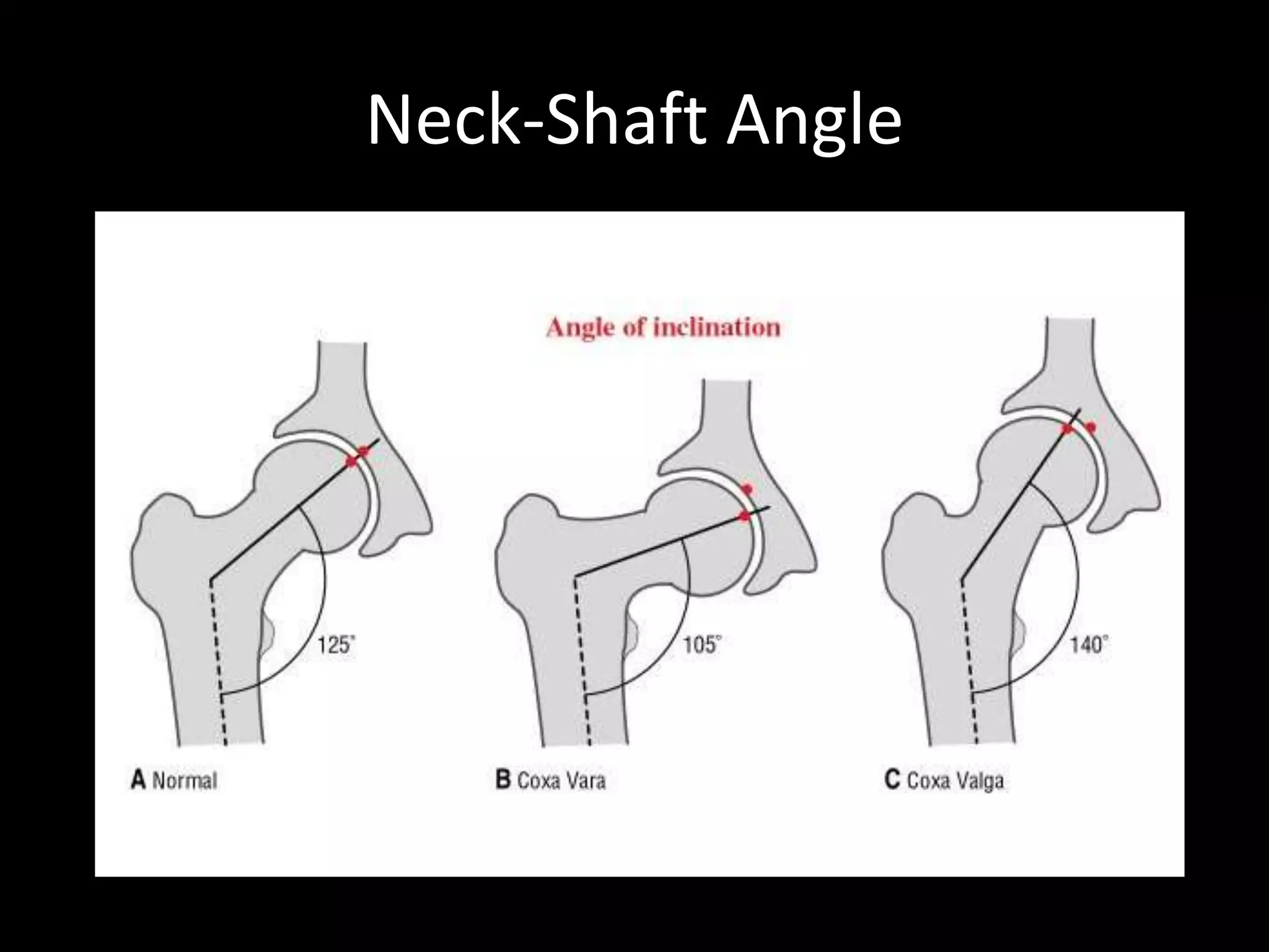 Surgical Approaches to Hip Joint | PPTX