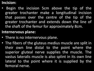 Surgical Approaches to Hip Joint | PPTX