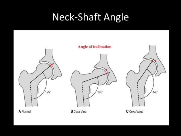 Surgical Approaches to Hip Joint | PPTX