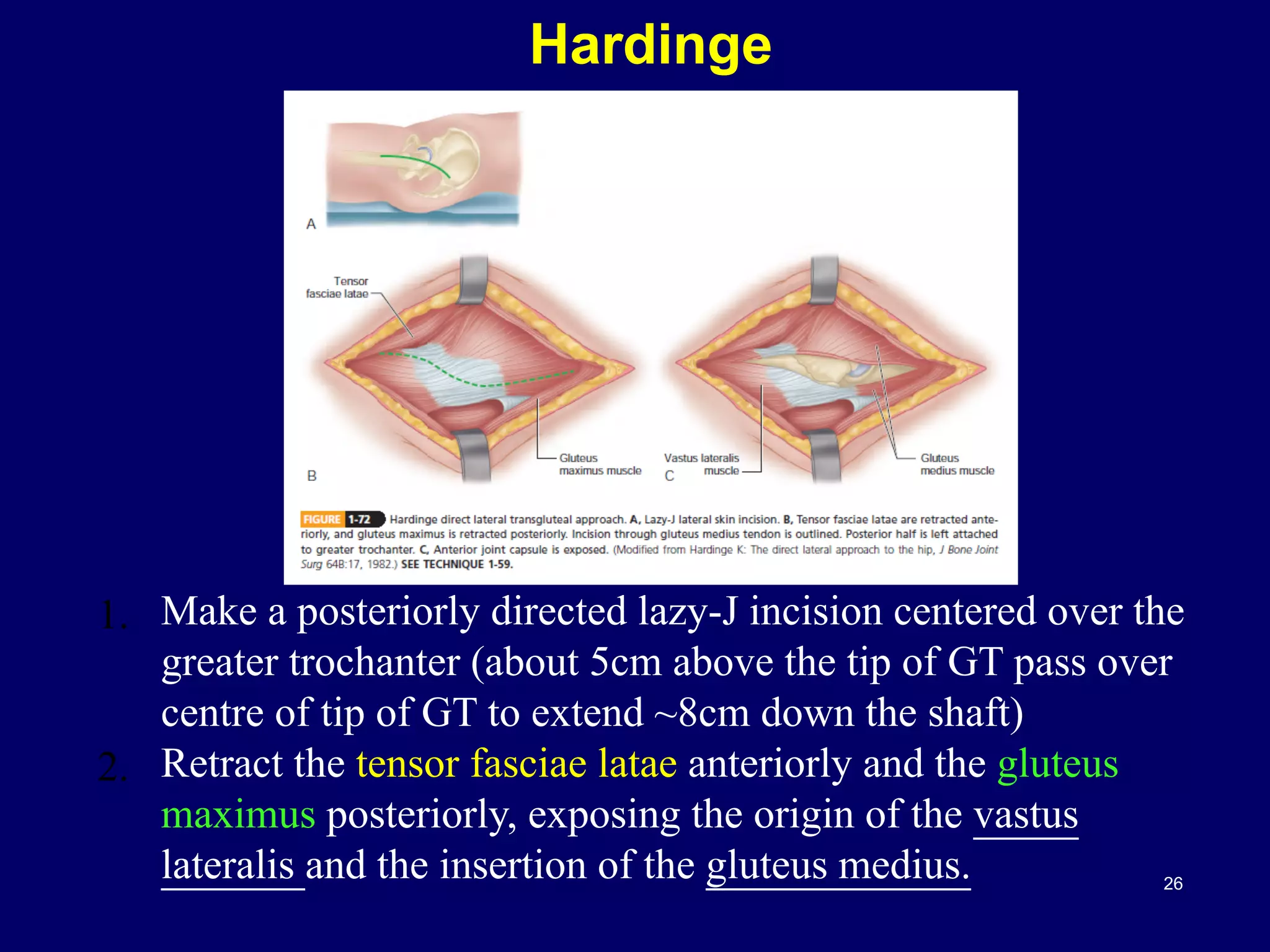 Hip Arthroplasty Approach.pdf