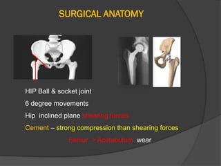 Hip arthroplasty surgical anatomy and approaches | PDF