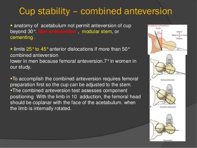 Hip arthroplasty surgical anatomy and approaches