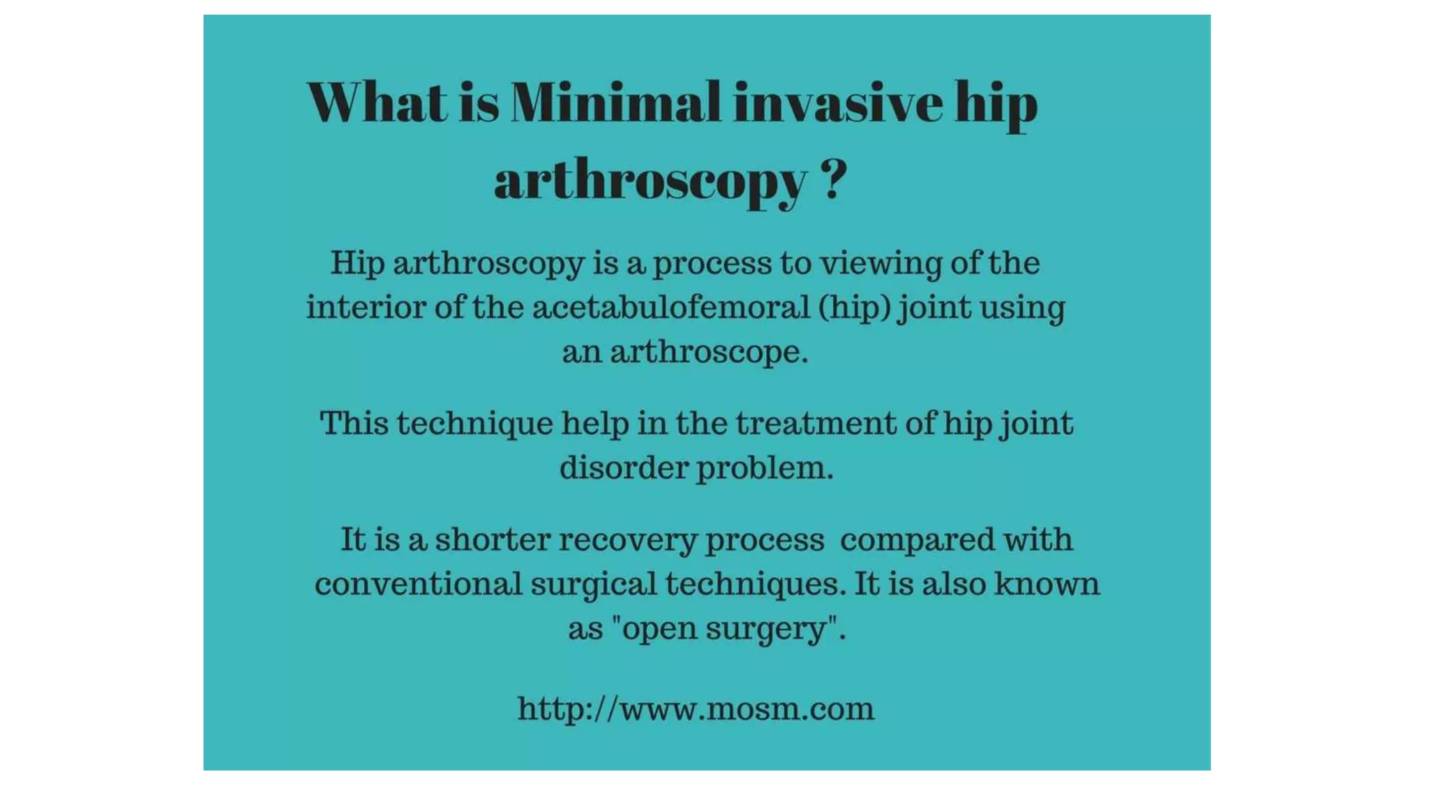 Hip arthroscopy | PPT