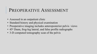 Hip Arthroscopy | PPTX