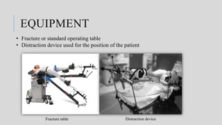 Hip Arthroscopy | PPTX