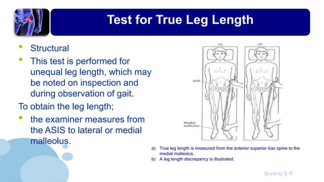 Hip Assessment SRS | PPT