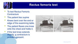 Rectus Femoris Contracture Test