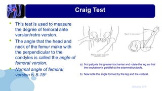 Hip Assessment SRS | PPT